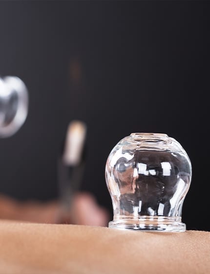 Cupping Course | Brisbane, Gold Coast, Sunshine Coast